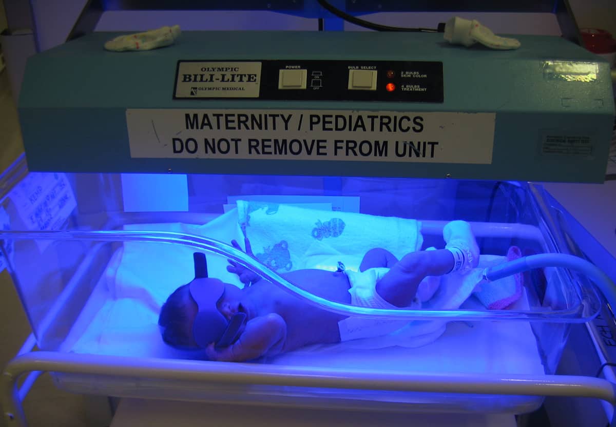 Neonatal Jaundice - almostadoctor