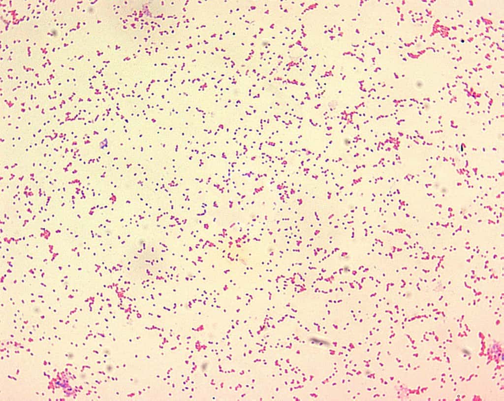 Brucellosis - almostadoctor