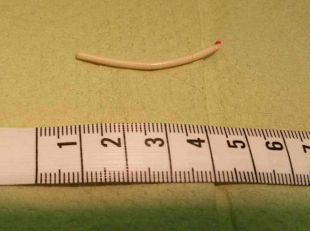 Contraception - Hormonal Implants - almostadoctor