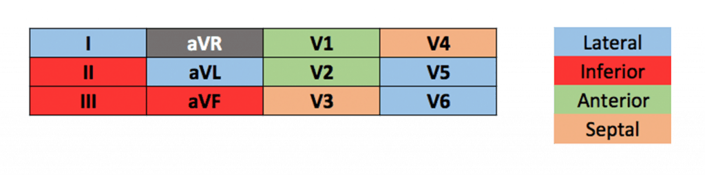 Myocardial Infarction and Acute Coronary Syndromes (ACS) | almostadoctor