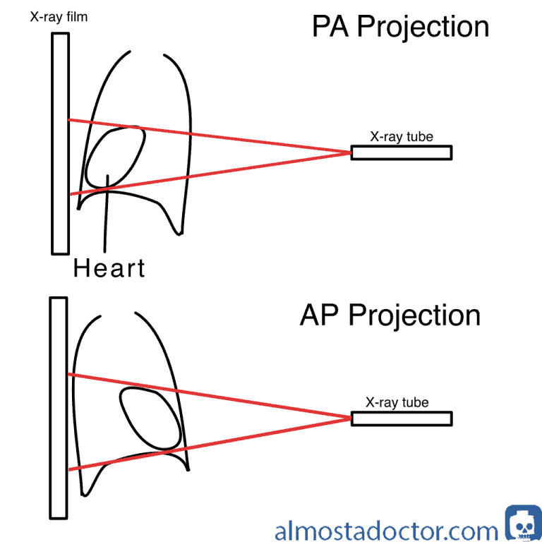 Chest X-Ray - almostadoctor