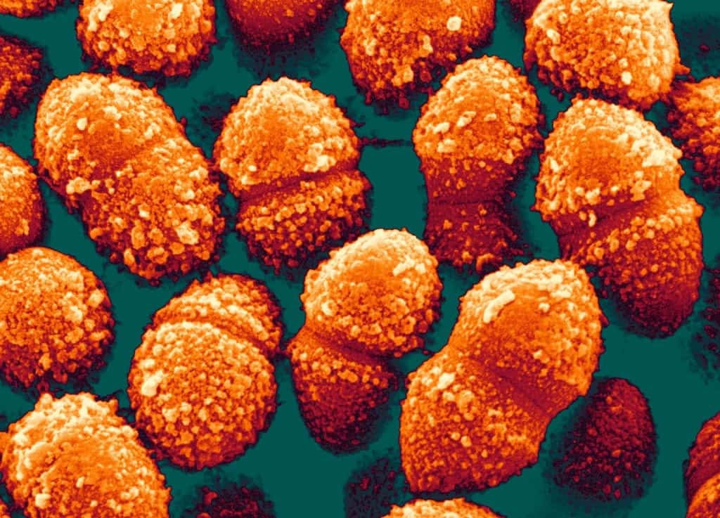 Gram Positive Bacteria - almostadoctor